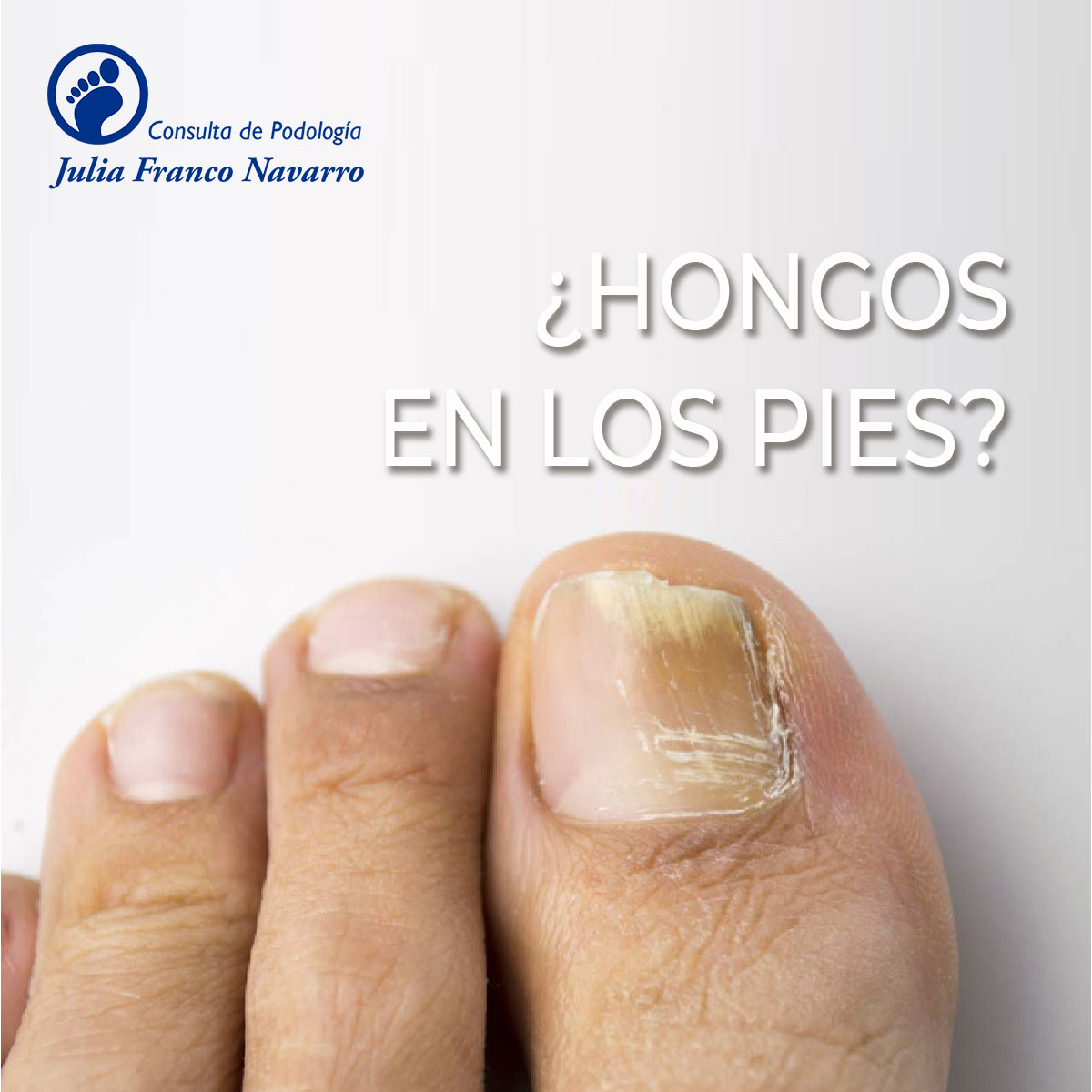 ¿HONGOS EN LOS PIES? 🍄 - Julia Franco Podóloga